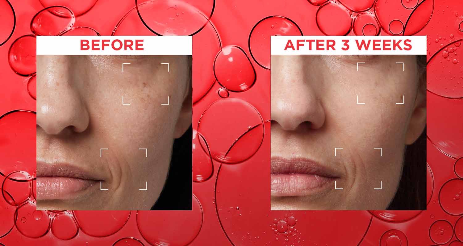 Revitalift Laser anti-ageing skincare - L'Oréal Paris